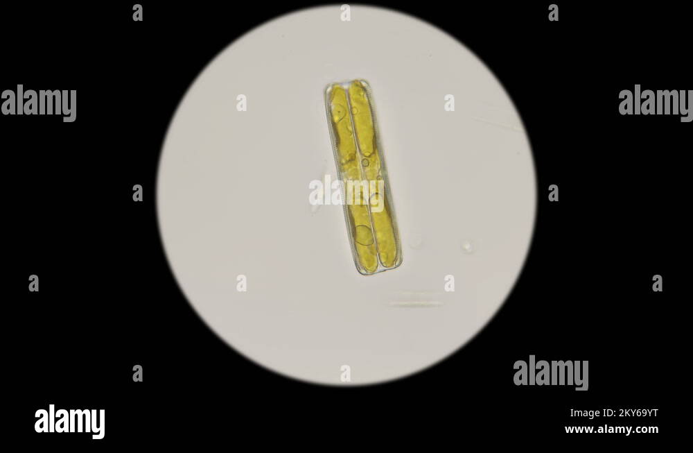 diatom algae in fresh water, under a microscope Stock Video Footage - Alamy