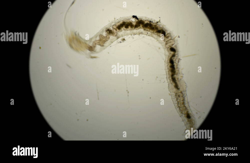 worm of the family Naididae, Pristina longiseta under the microscope ...