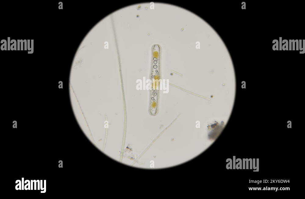 diatom algae in fresh water, under a microscope Stock Video Footage - Alamy
