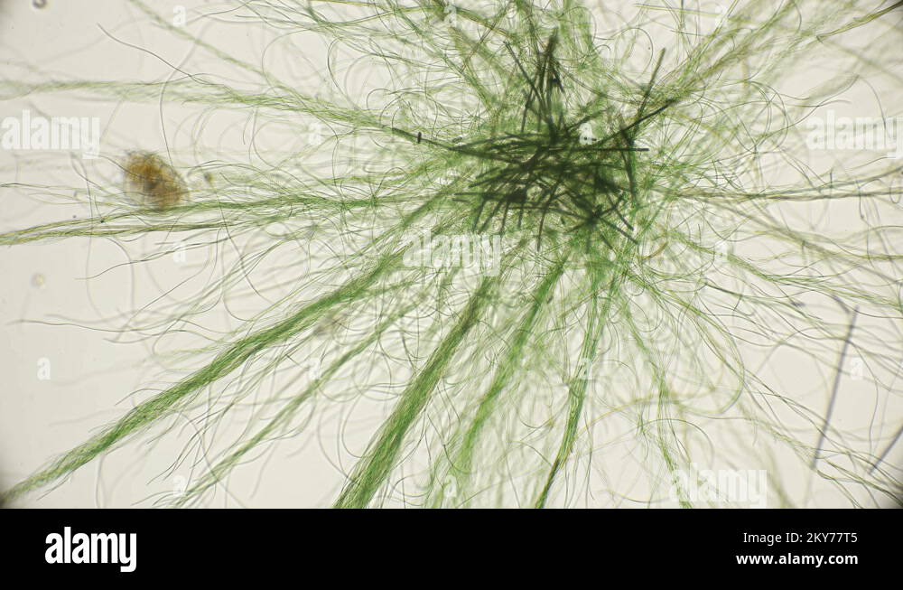 movement of live algae under a microscope, similar to the tentacles of ...