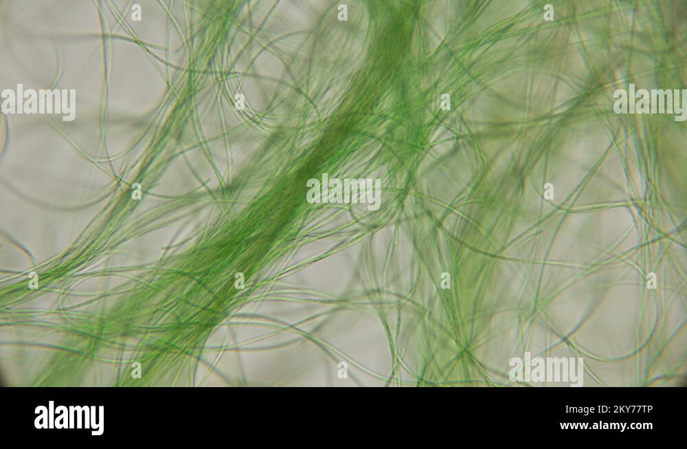 movement of live algae under a microscope, similar to the tentacles of ...