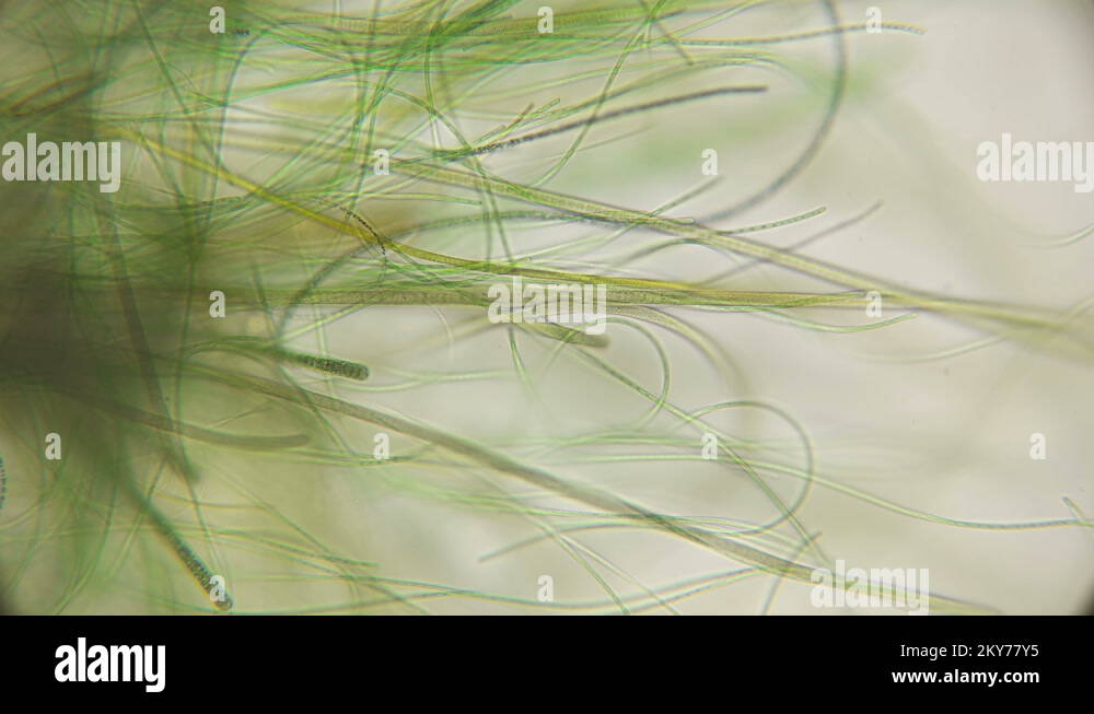 movement of live algae under a microscope, similar to the tentacles of ...