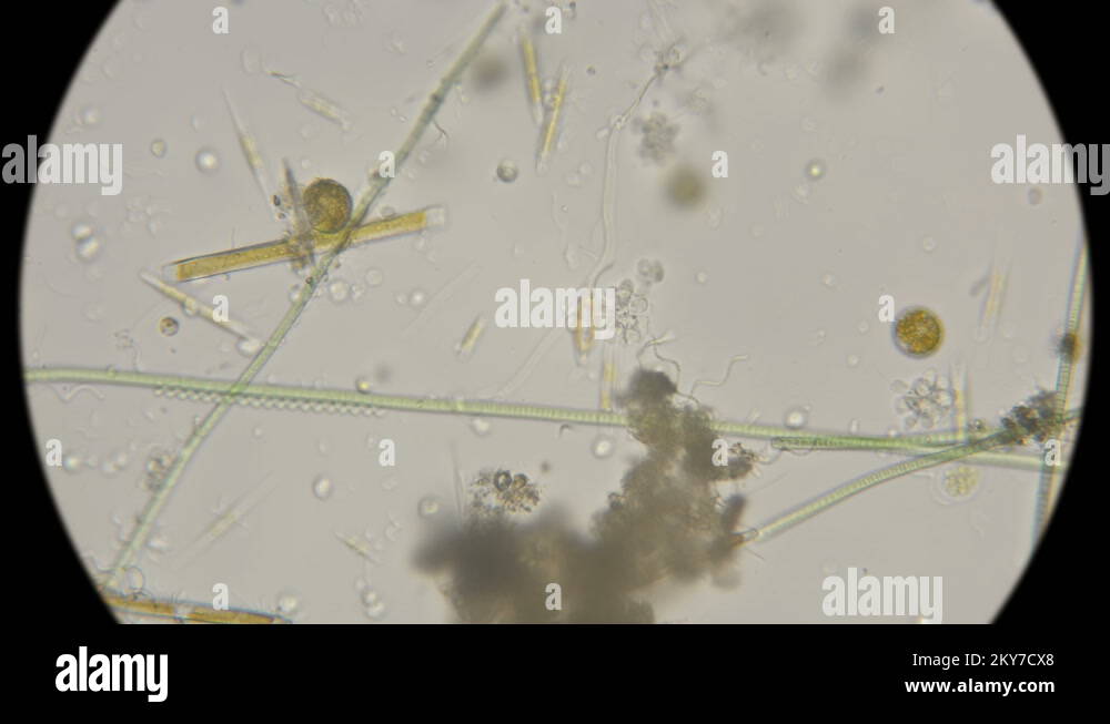 a variety of microorganisms in one drop of water under a microscope ...