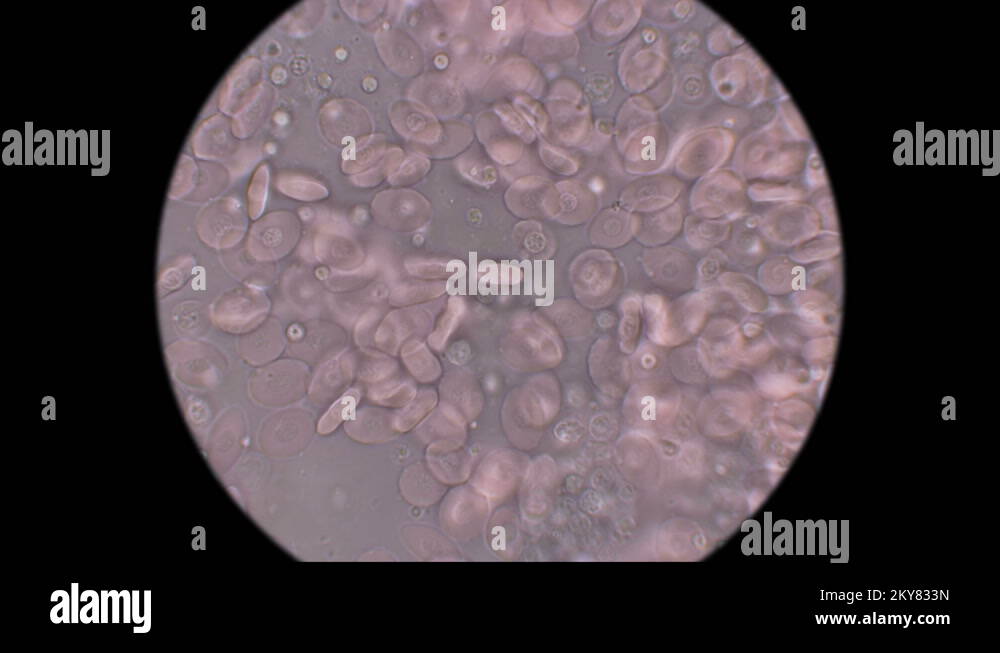 Albumin flow Stock Videos & Footage - HD and 4K Video Clips - Alamy