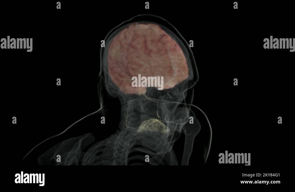 Anatomy of taste Stock Videos & Footage - HD and 4K Video Clips - Alamy