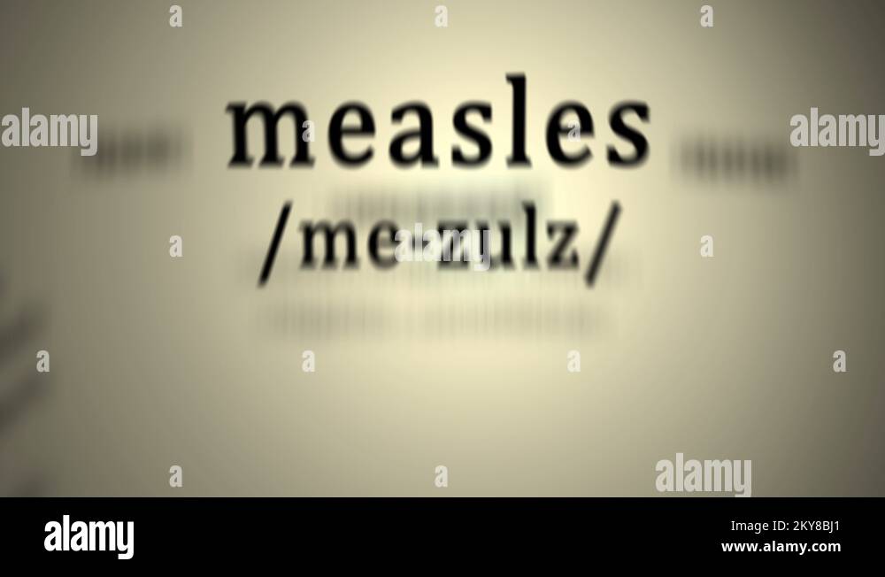 Measles Stock Videos & Footage - HD and 4K Video Clips - Alamy Measles Stock Videos & Footage - HD and 4K Video Clips - Alamy