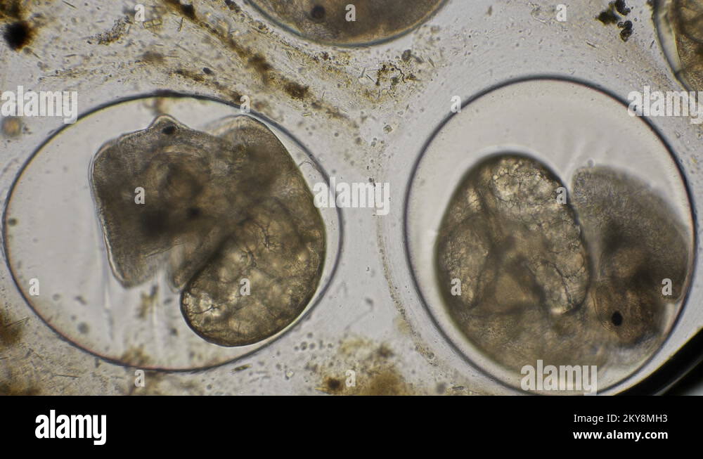 movement of the eggs of the Snail Planorbis under a microscope Stock ...