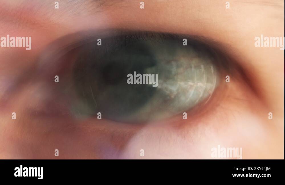 Mass observation Stock Videos & Footage - HD and 4K Video Clips - Alamy