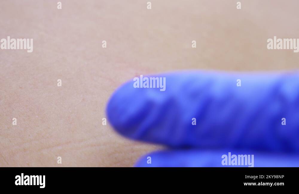 doctor dermatovenereologist makes an injection of anesthesia in the ...