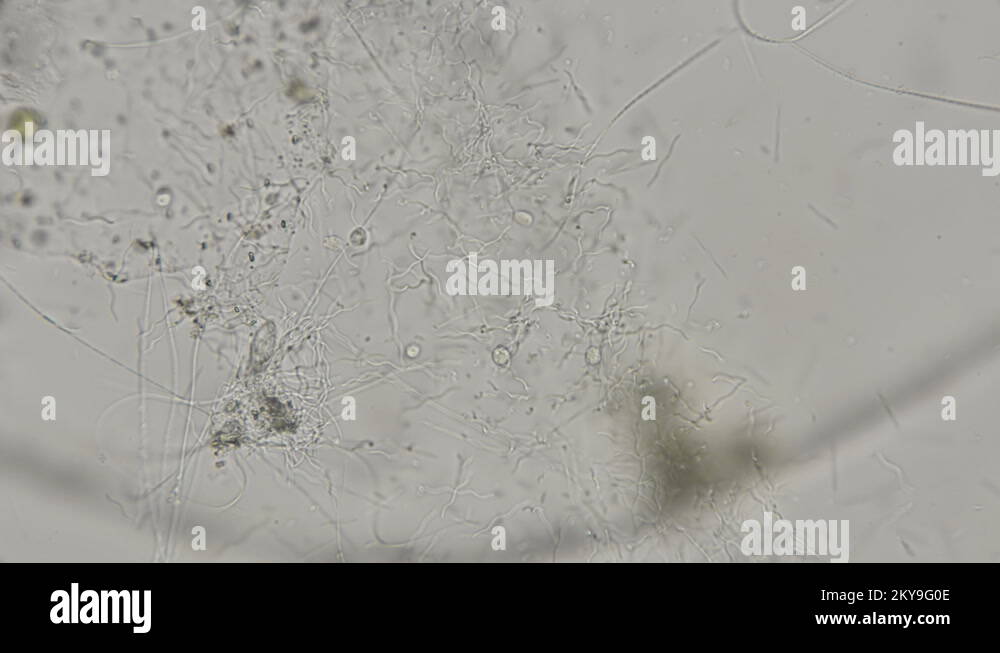 colony of bacteria spirochetes under a microscope Stock Video Footage ...