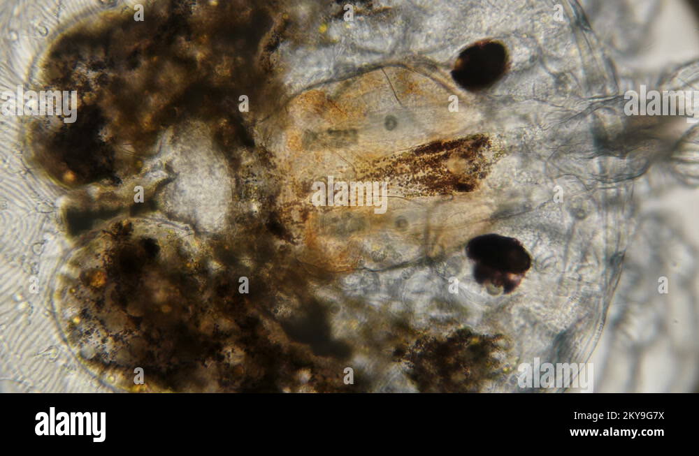 the internal organs of the water mite, under a microscope Stock Video ...