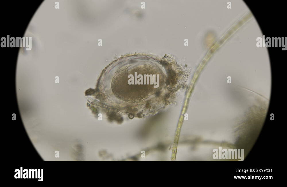 the cyst of the simplest microorganism under a microscope Stock Video ...