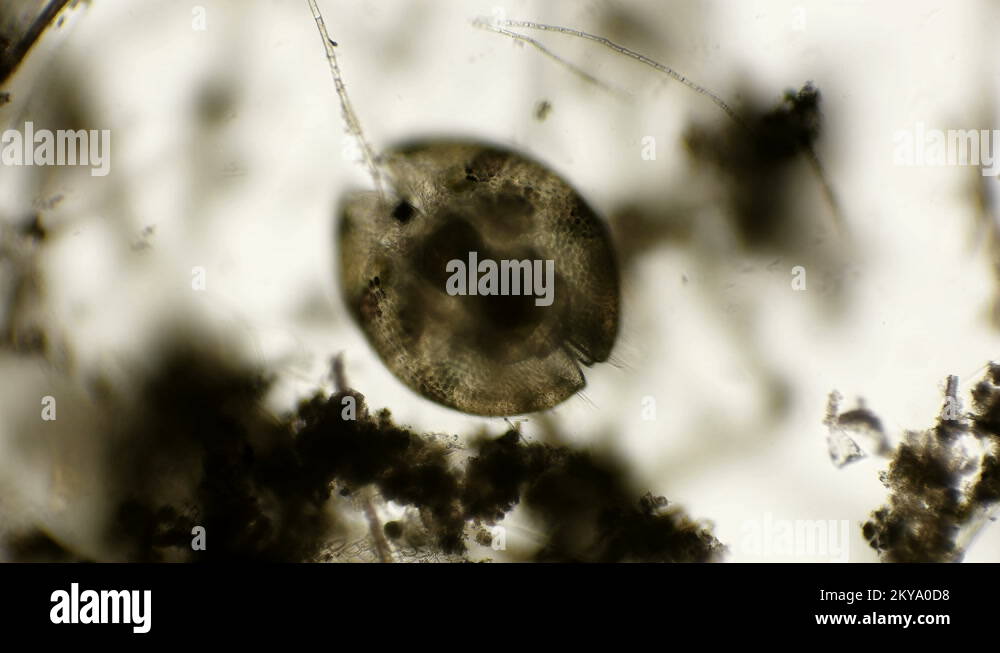 Chitin shellfish Stock Videos & Footage - HD and 4K Video Clips - Alamy