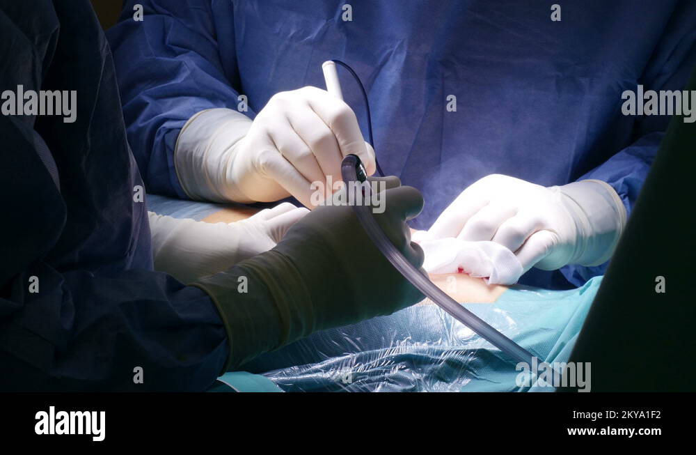 Surgeonsteam Stock Videos & Footage - HD and 4K Video Clips - Alamy