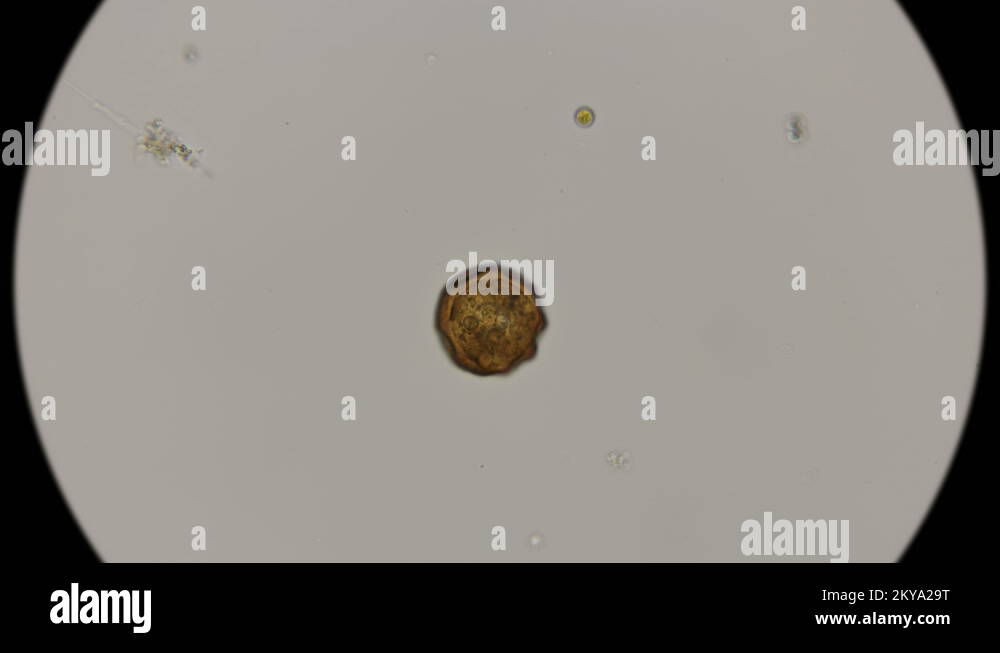 Nematodes microscope Stock Videos & Footage - HD and 4K Video Clips - Alamy