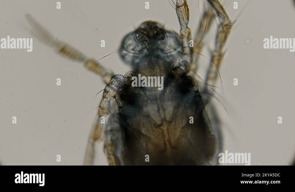 Scary invertebrates Stock Videos & Footage - HD and 4K Video Clips - Alamy