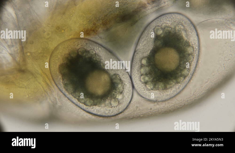 Body under a microscope Stock Videos & Footage - HD and 4K Video Clips ...
