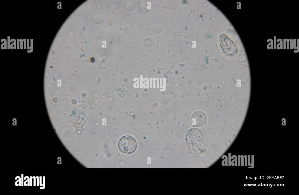 the hemolymph of the so-called blue blood of a crayfish under a ...