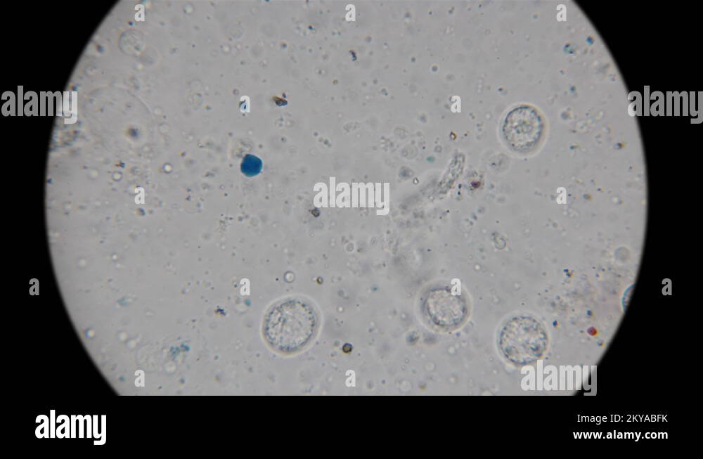 the hemolymph of the so-called blue blood of a crayfish under a ...