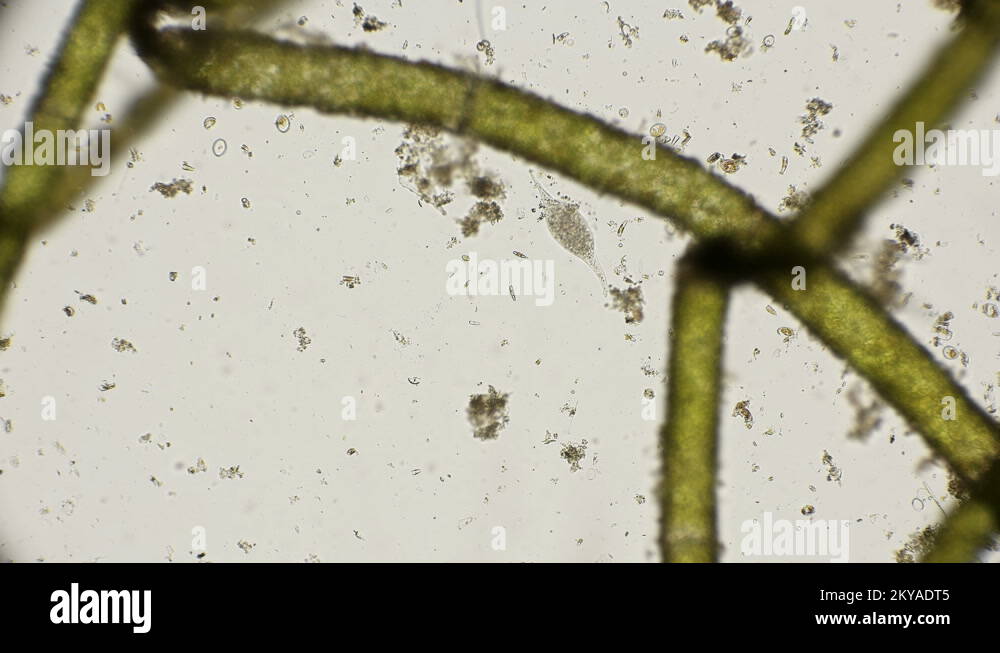 Litonotus infusoria under a microscope Stock Video Footage - Alamy