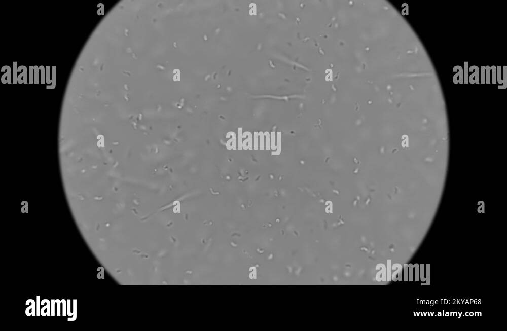 Vibrio bacteria Stock Videos & Footage - HD and 4K Video Clips - Alamy