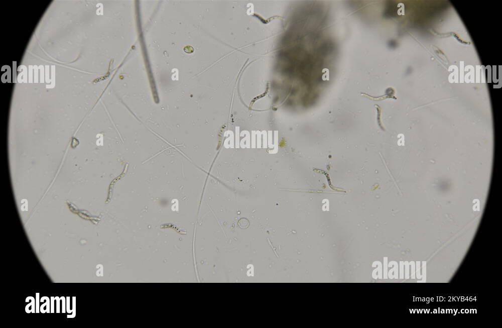 spiral, curved bacterium, a parasite ,under the microscope Stock Video ...