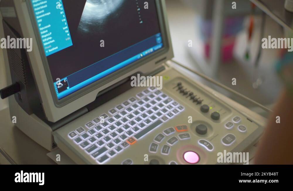 Sonograph Stock Videos & Footage - HD and 4K Video Clips - Alamy