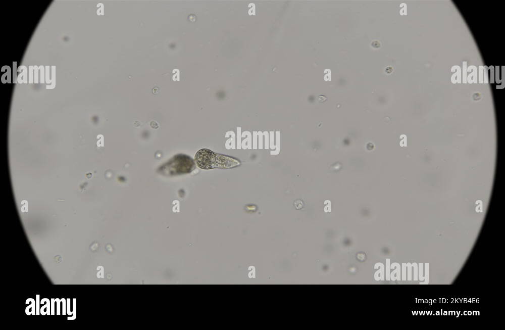 division of peranema microorganism, under a microscope Stock Video ...