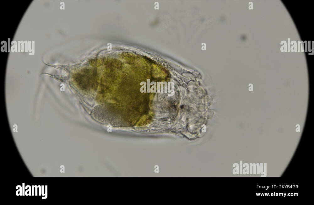 Dilatata Stock Videos & Footage - HD and 4K Video Clips - Alamy