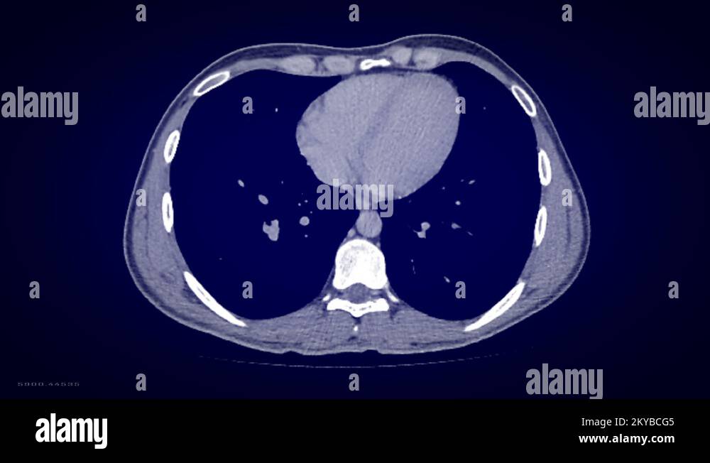MRI and CT technology concept. Scanning process. X-ray emitting Stock ...