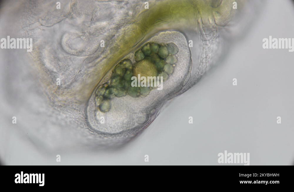 eggs, embryos in the brood chamber of daphnia of different stages ...