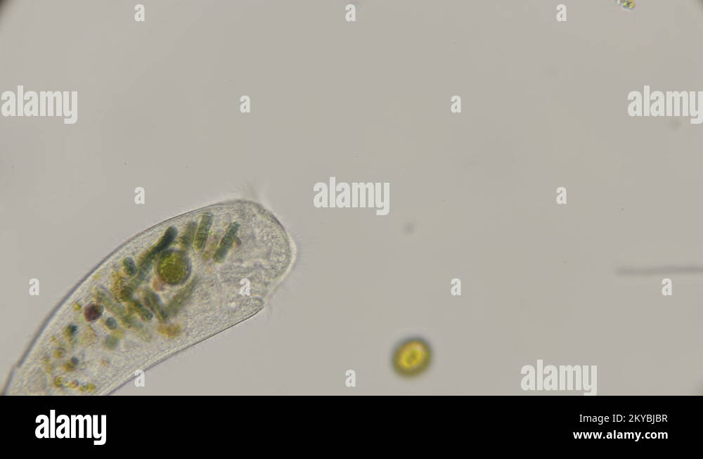 Infusoria Stentor, class Ciliata stretches in search of food, under a ...