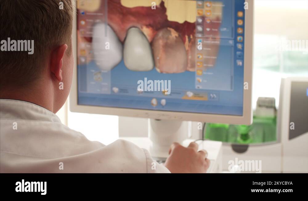 Orthodontist works with 3D model of tooth crown on computer. Screen is ...