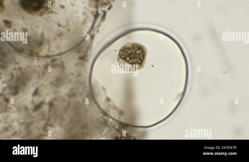 Initial development Stock Videos & Footage - HD and 4K Video Clips - Alamy