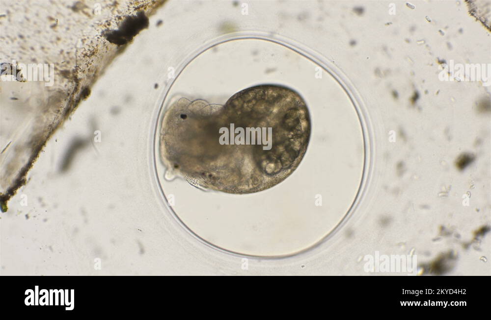 movement of the formed cochlea embryo, under a microscope Stock Video ...