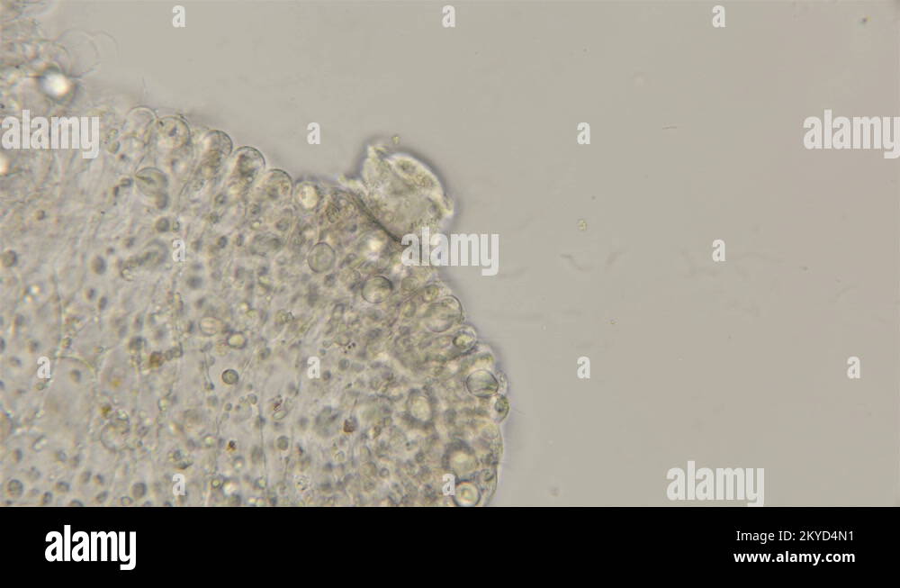the movement of the infusorian Trichodina, which is a commensal, and is ...