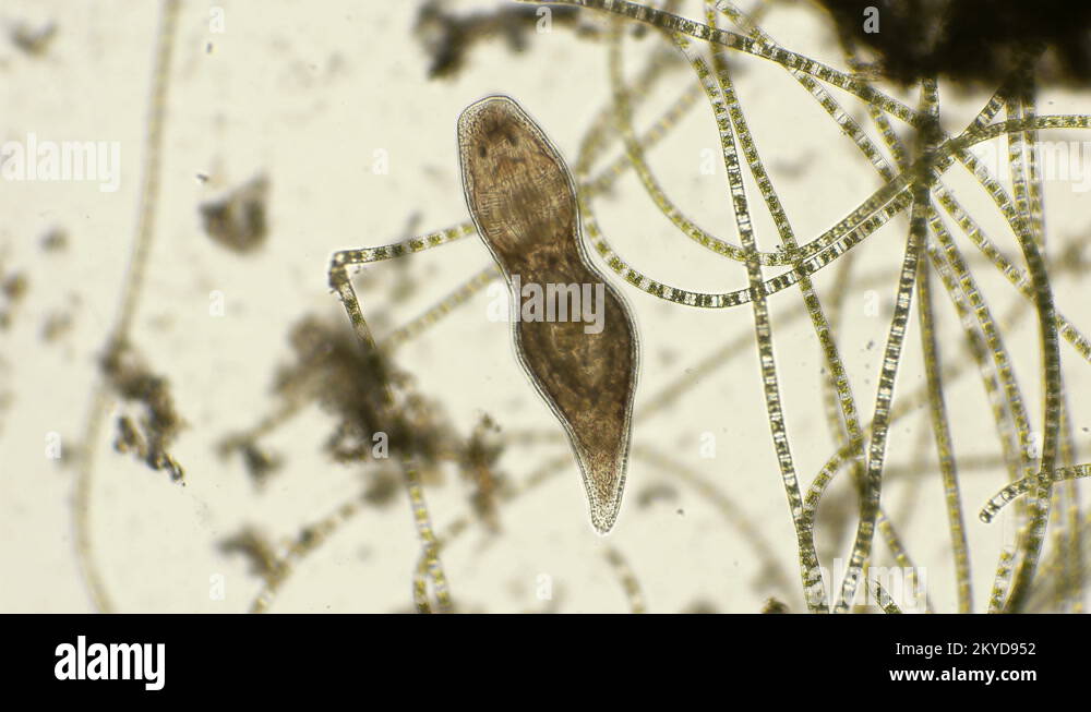 rectum worm TURBELLY of the genus Dalyellia, under a microscope Stock ...