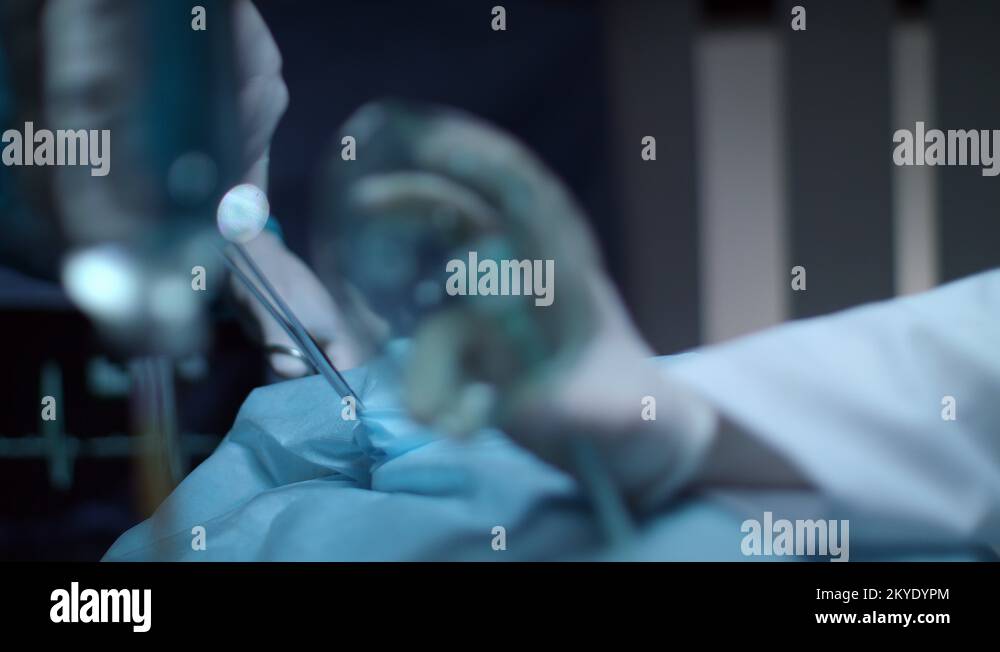 Operation anesthetic mask Stock Videos & Footage - HD and 4K Video ...