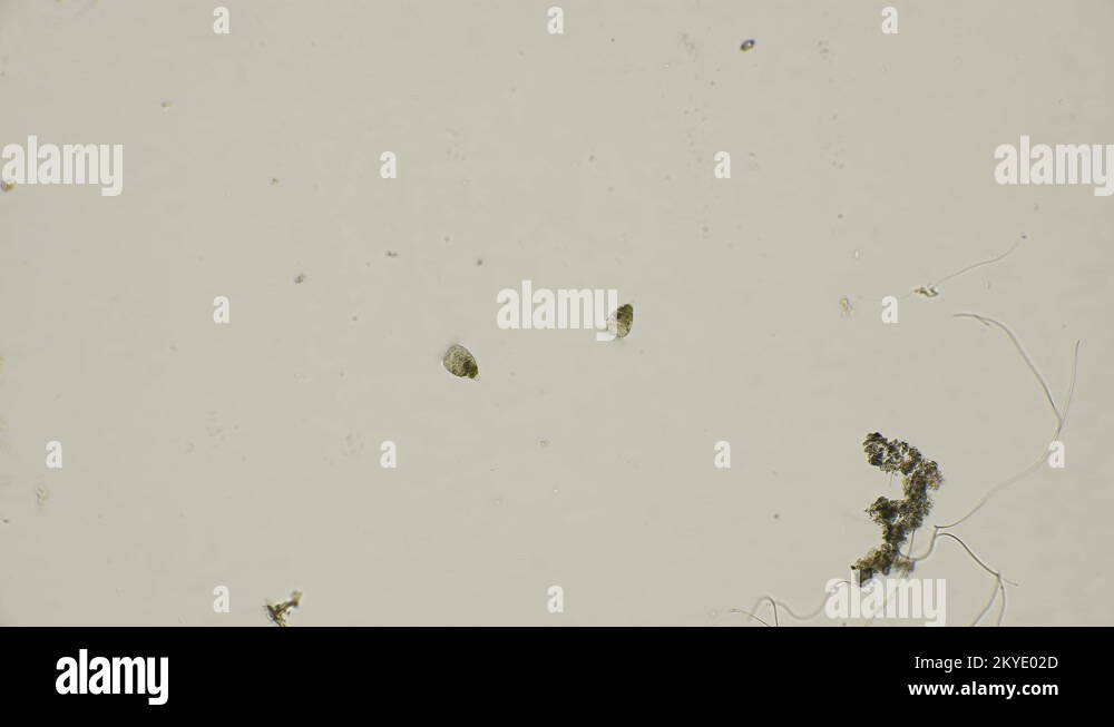 the microorganism Strobilidium, Class Ciliatea, considered a separate ...