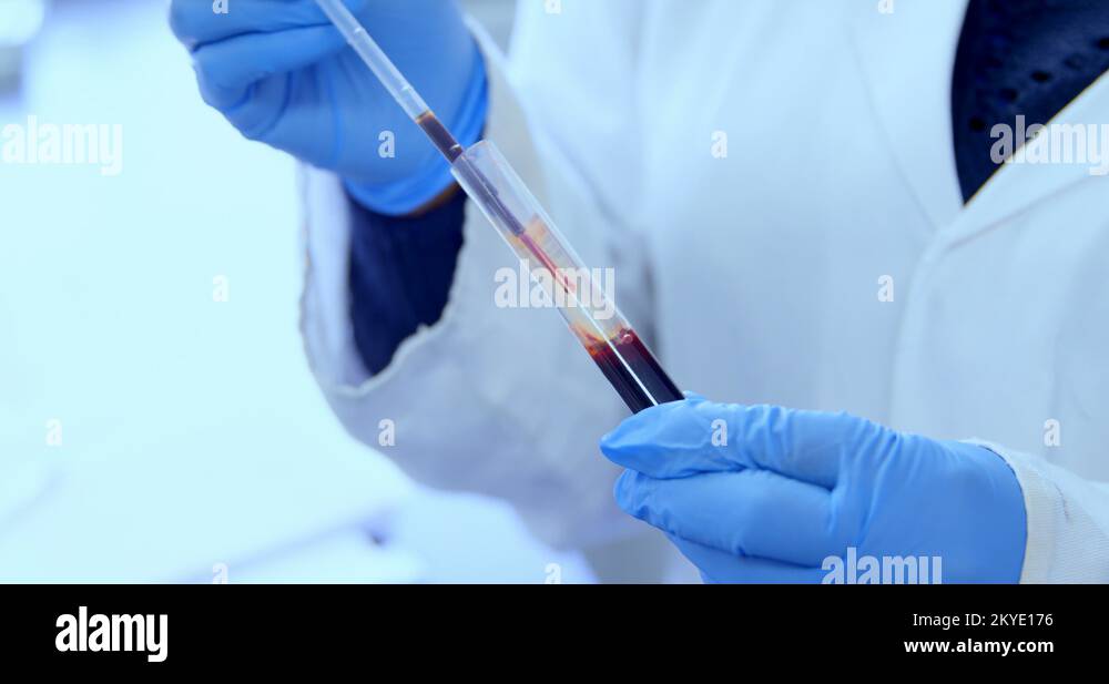 Doctor testing blood sample Stock Videos & Footage - HD and 4K Video ...