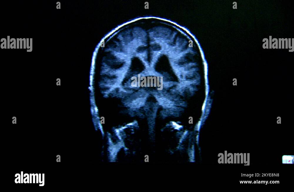 Brain of britain Stock Videos & Footage - HD and 4K Video Clips - Alamy