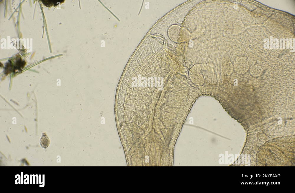an oligochaete intestinal worm with a large open mouth in motion, under ...