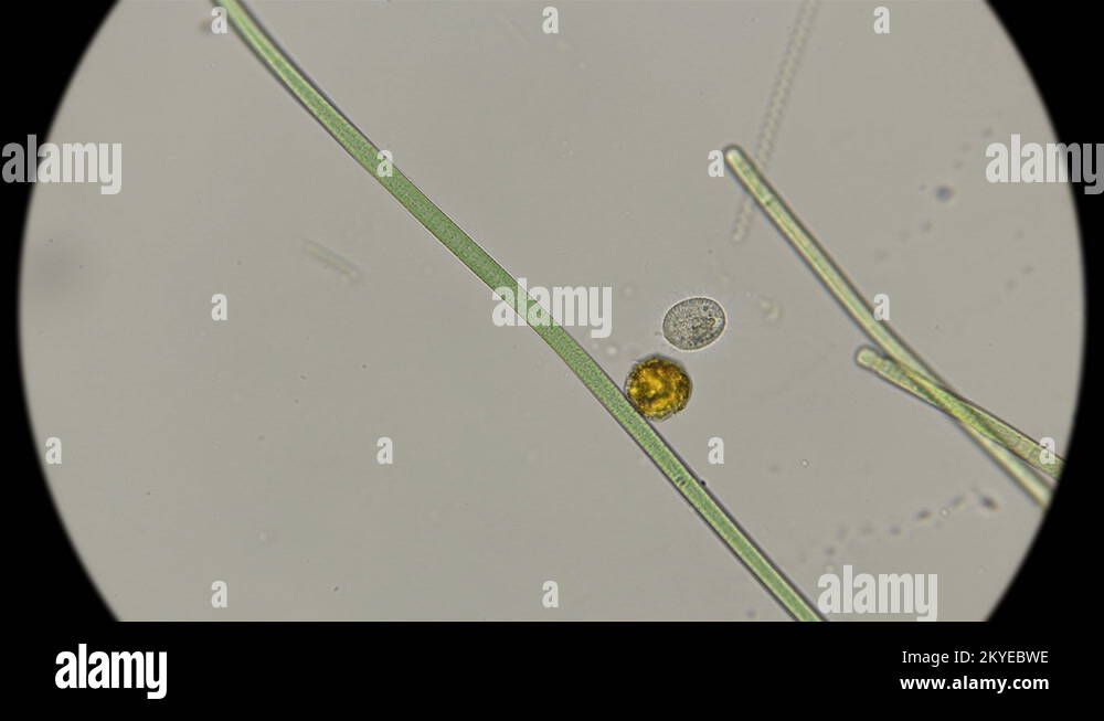 Infusoria Urotricha farcta, which serves as an indicator of water ...