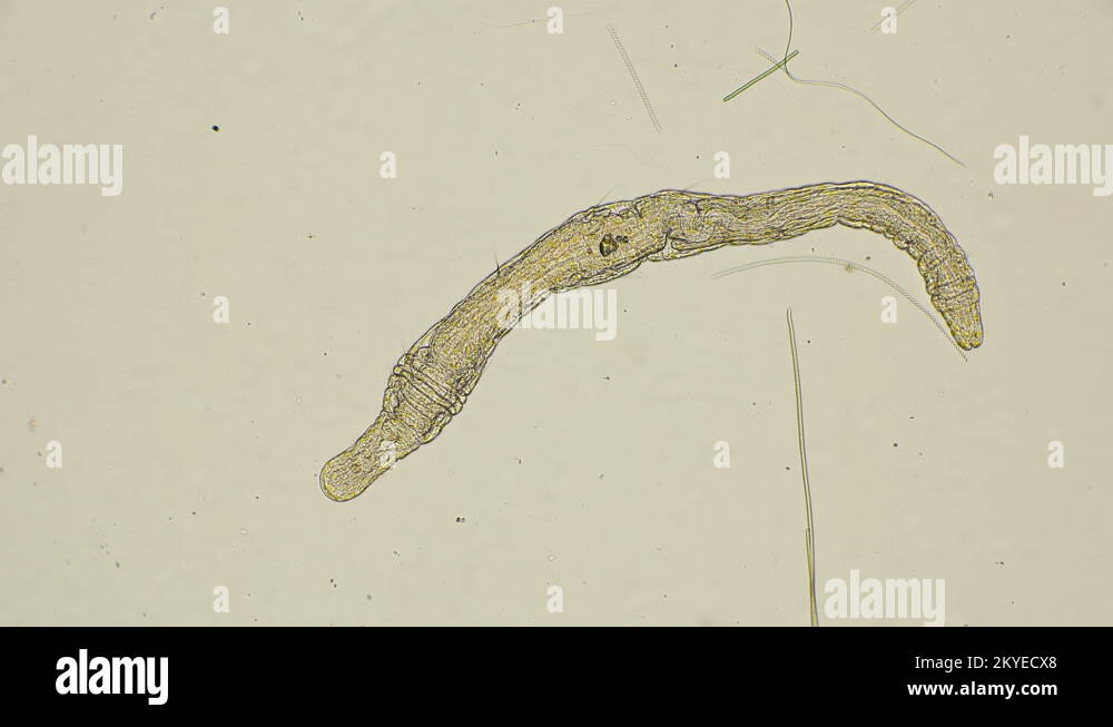 worm of the family Aeolosomatidae, Aeolosoma hemprichi, under the ...