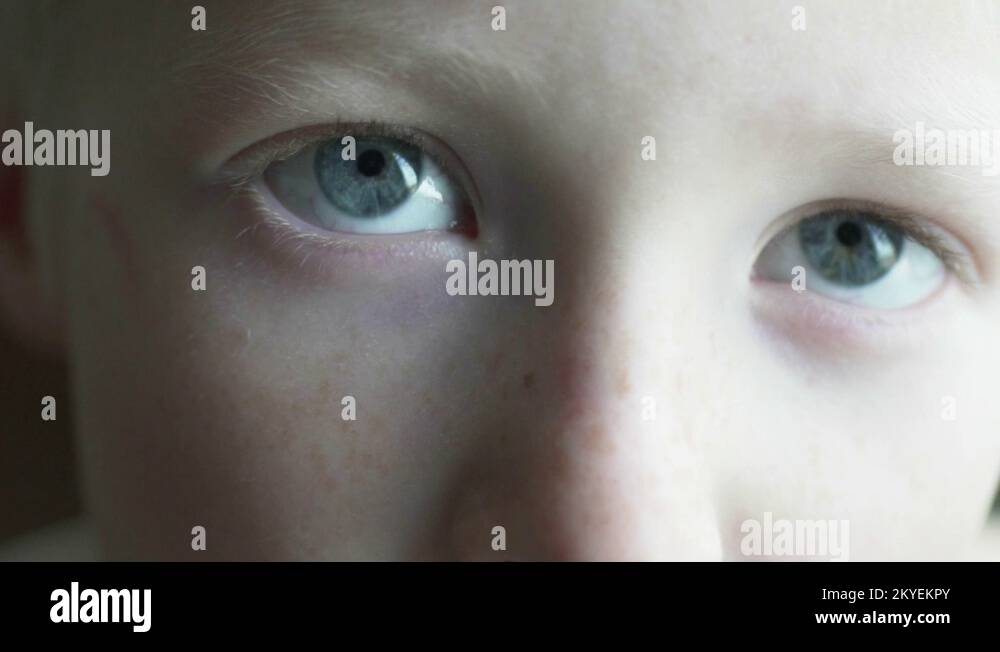 Albino human eye Stock Videos & Footage - HD and 4K Video Clips - Alamy