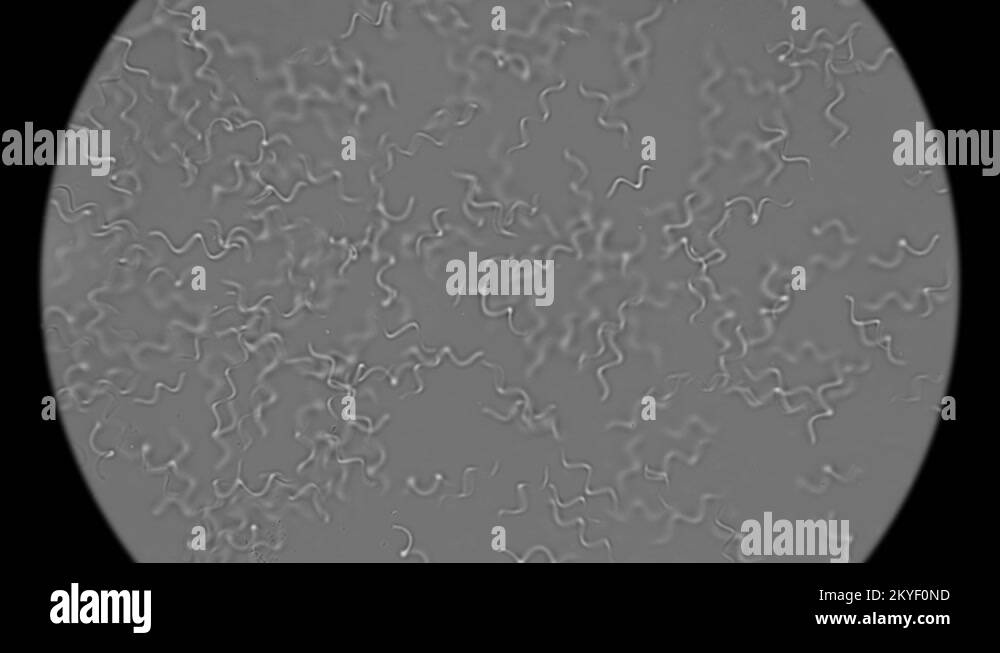 Typhus bacteria Stock Videos & Footage - HD and 4K Video Clips - Alamy