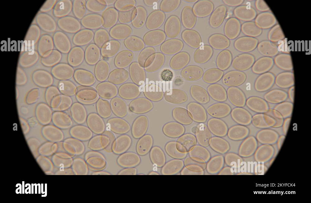 Movement in the blood of erythrocytes and one leukocyte under a ...