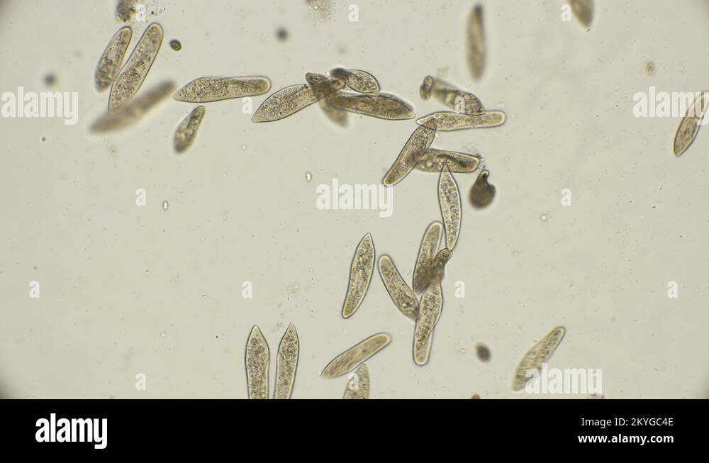 colony Infusorium Paramécium caudátum in motion, under a microscope ...