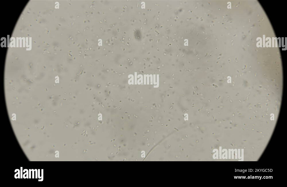 a drop of dirty water with a lot of bacteria and microorganisms, under ...