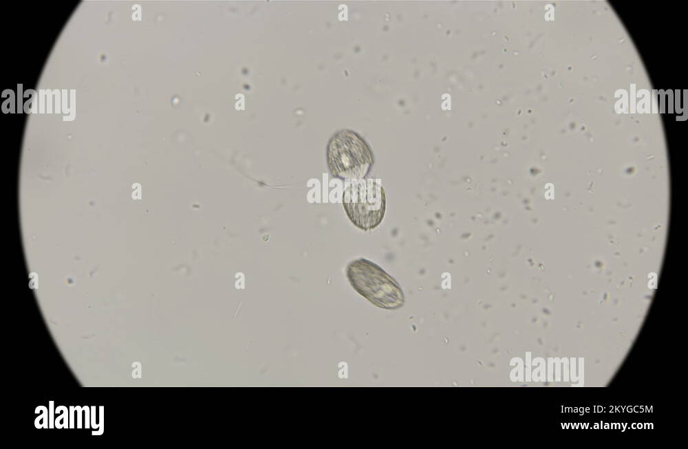 Colony division Stock Videos & Footage - HD and 4K Video Clips - Alamy